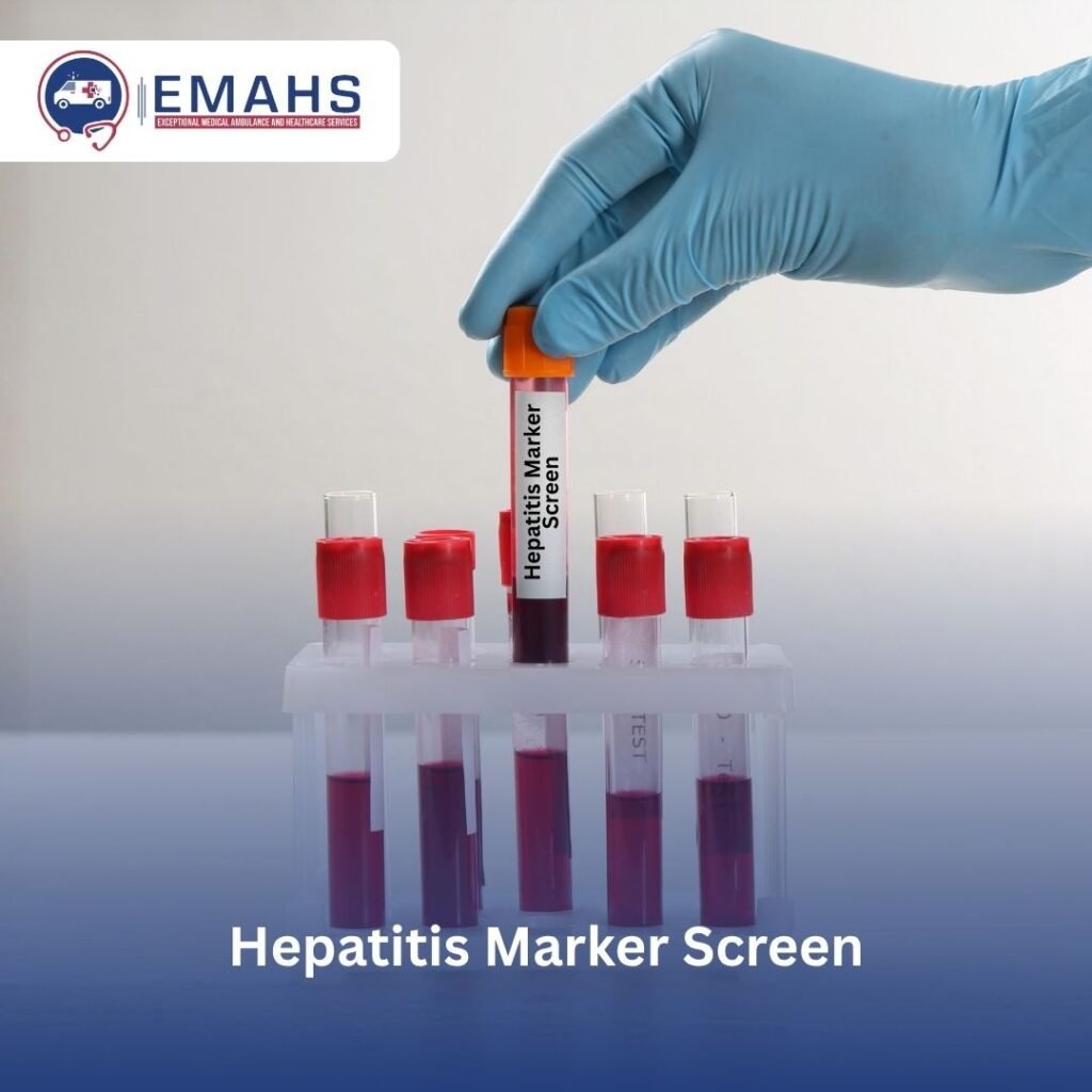 Hepatitis Marker Screen - EMAHS