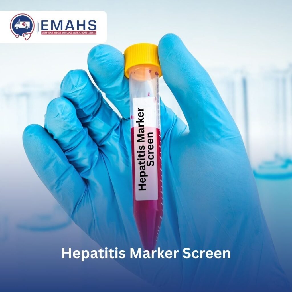Hepatitis Marker Screen - EMAHS